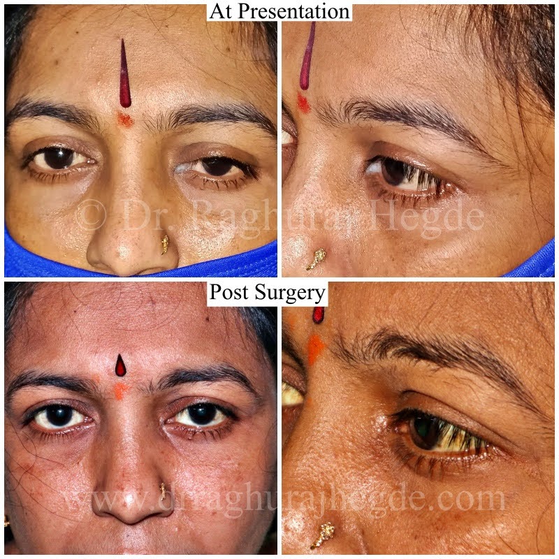 Where is the scar? – DR. RAGHURAJ HEGDE